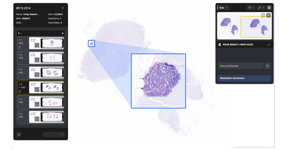 Paige Launches AI Software to Enable Accurate and Efficient Detection ...